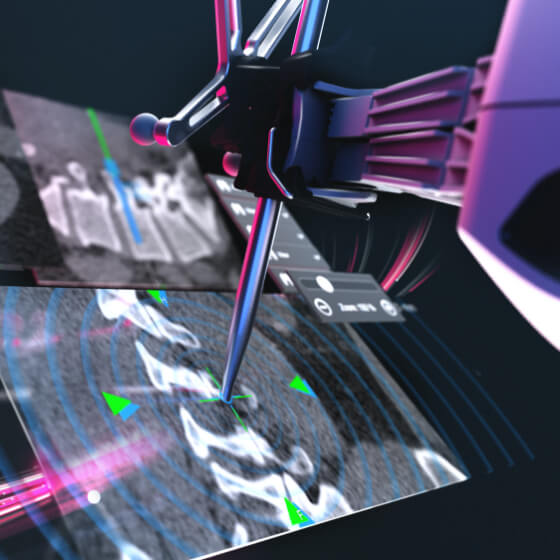 Experience Loop-X®: Mobile Robotic Imaging | Brainlab