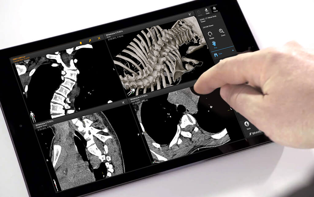 How Brainlab Digital O.R. Improves Surgical Documentation | Brainlab