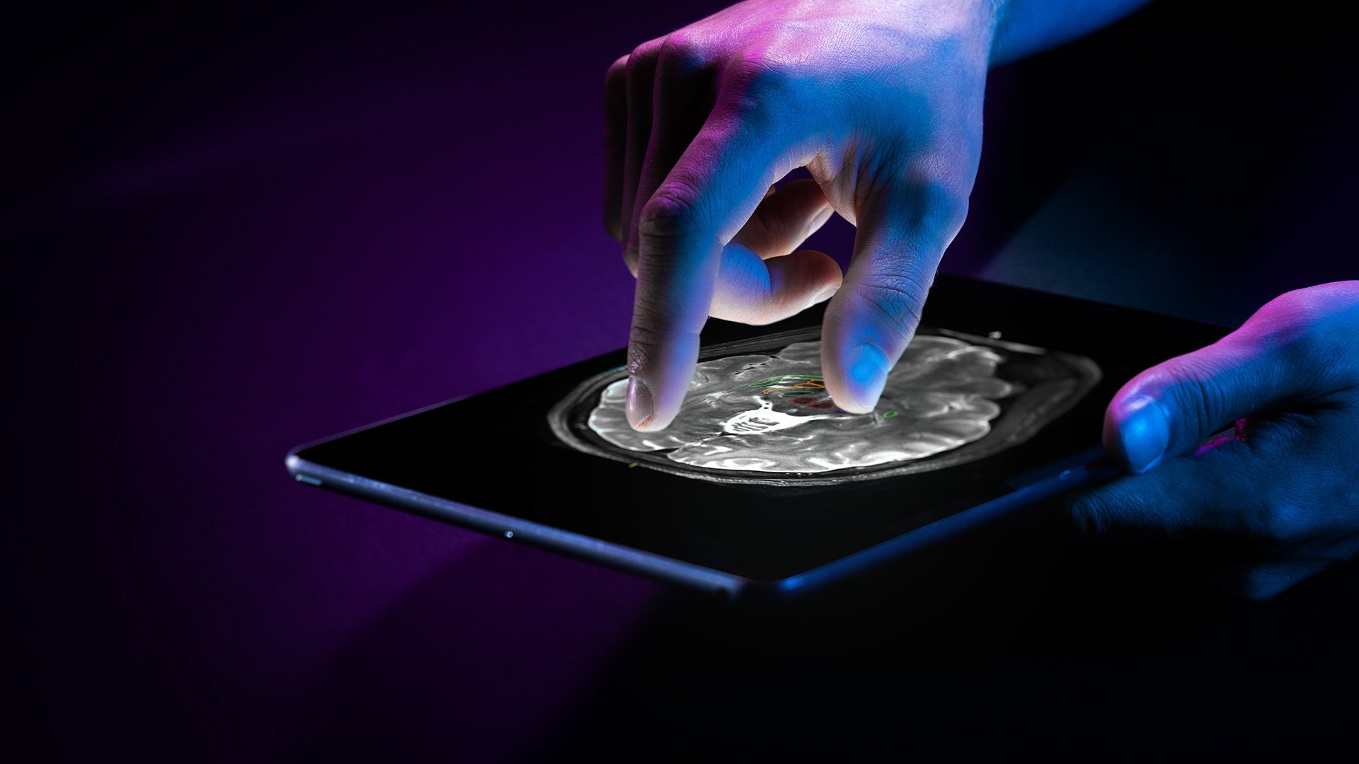 Explore Brainlab: Our Culture and Innovative Spirit | Brainlab