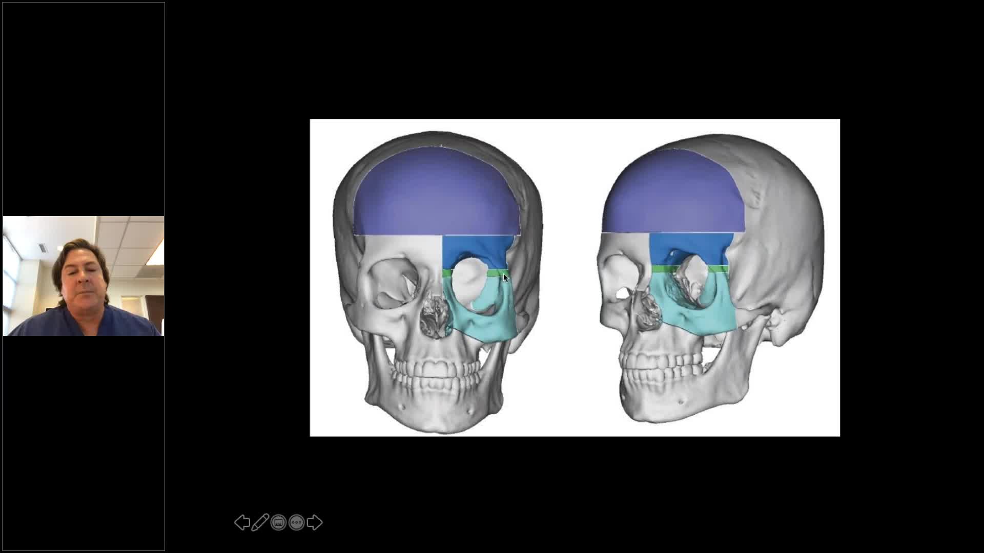 Computer-assisted Surgery for Reconstruction of Post-Traumat | Brainlab Computer-assisted Surgery for Reconstruction of Post-Traumat | Brainlab